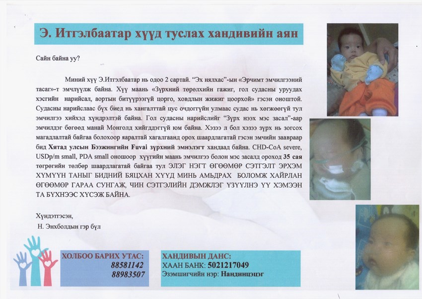 Э Итгэлбаатар хүүд туслах хандивын аянд нэгдэхийг уриалж байна